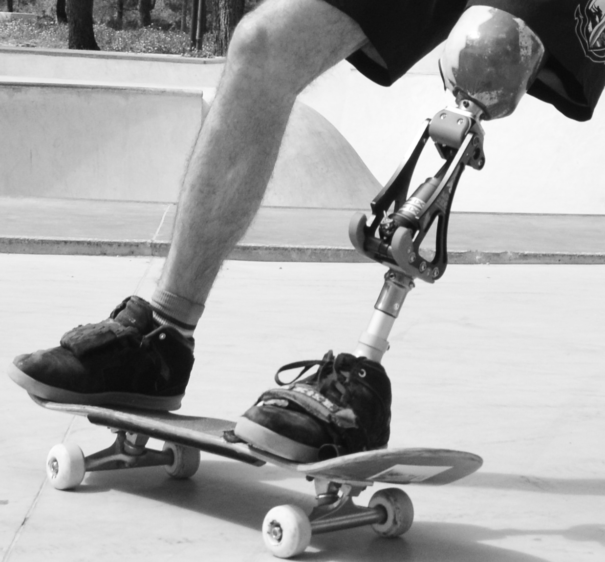 Prothèse Fémorale – BTC Orthopédie